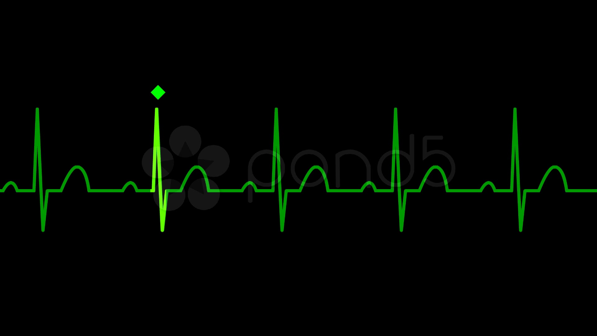 Ecg Ekg Graph Background Stock Video 78259 | HD Stock Footage